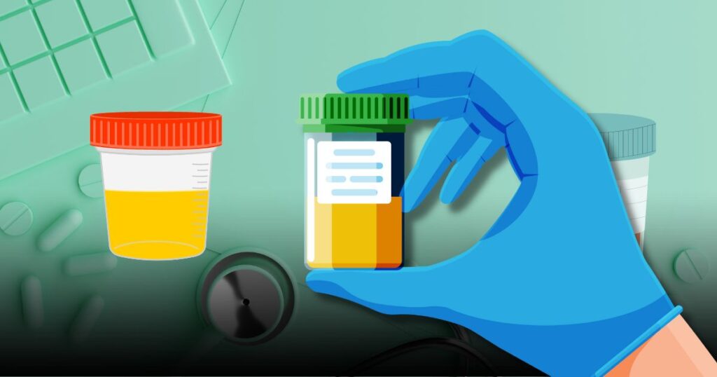 Alerta para SAÚDE? Significado da cor da urina; entenda