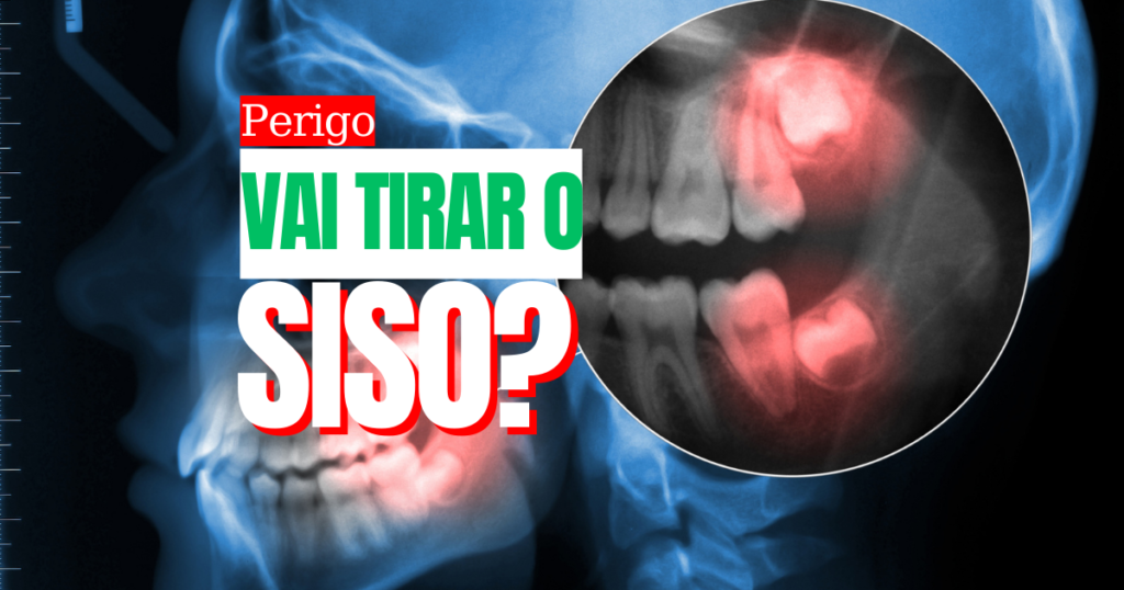 Vai tirar o siso? Descubra quais são os verdadeiros perigos