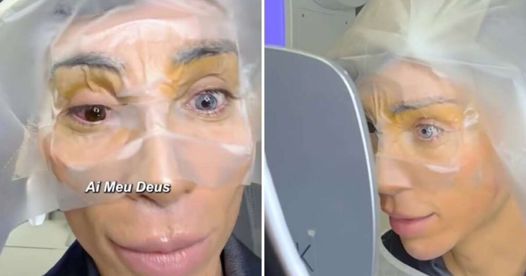 Maya Massafera mostra resultado de cirurgia para mudar cor dos olhos
